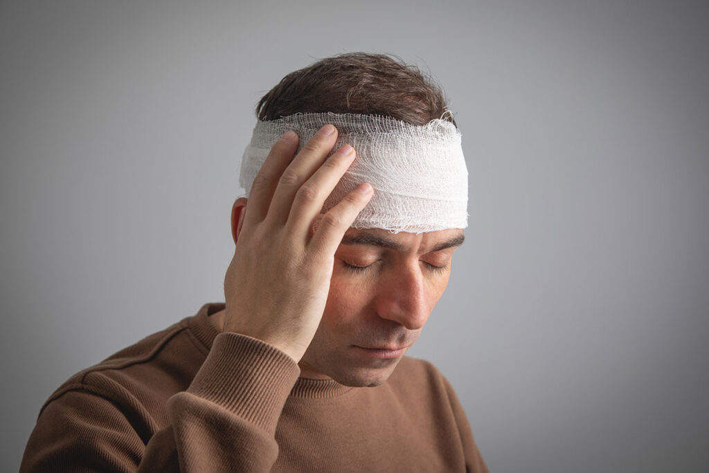 What To Do After a Head Injury: Protect Your Rights